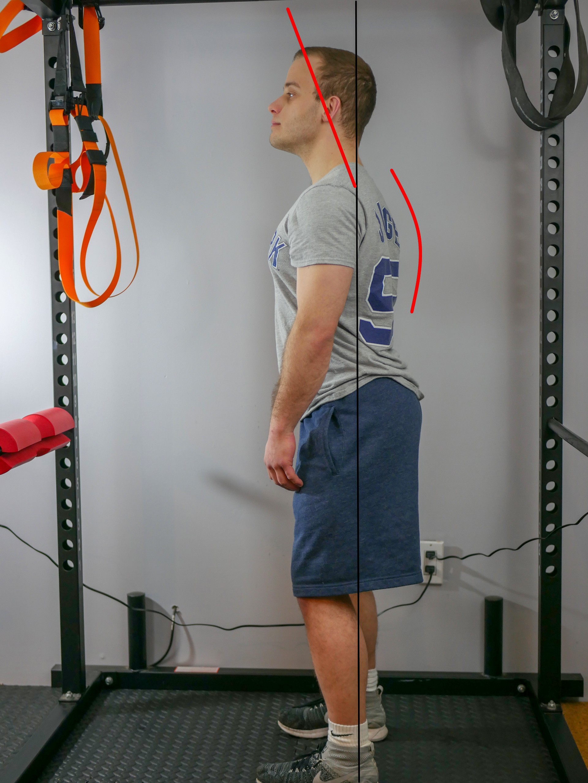 Static Posture Assessment – Strong Links Fitness