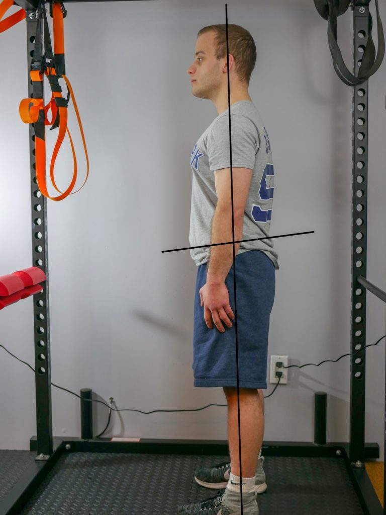 Static Posture Assessment – Strong Links Fitness