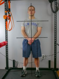 Static Posture Assessment – Strong Links Fitness