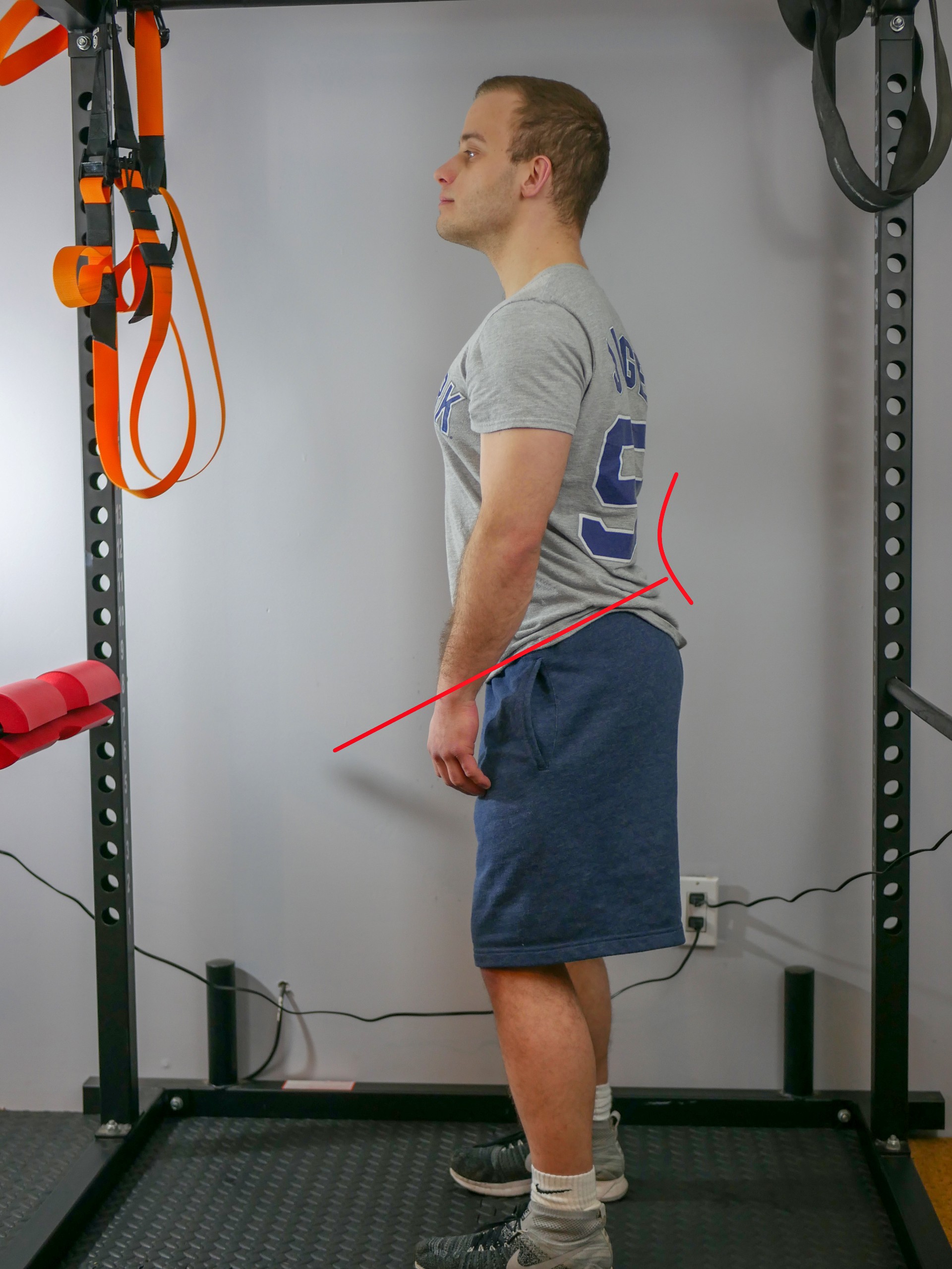 Static Posture Assessment – Strong Links Fitness